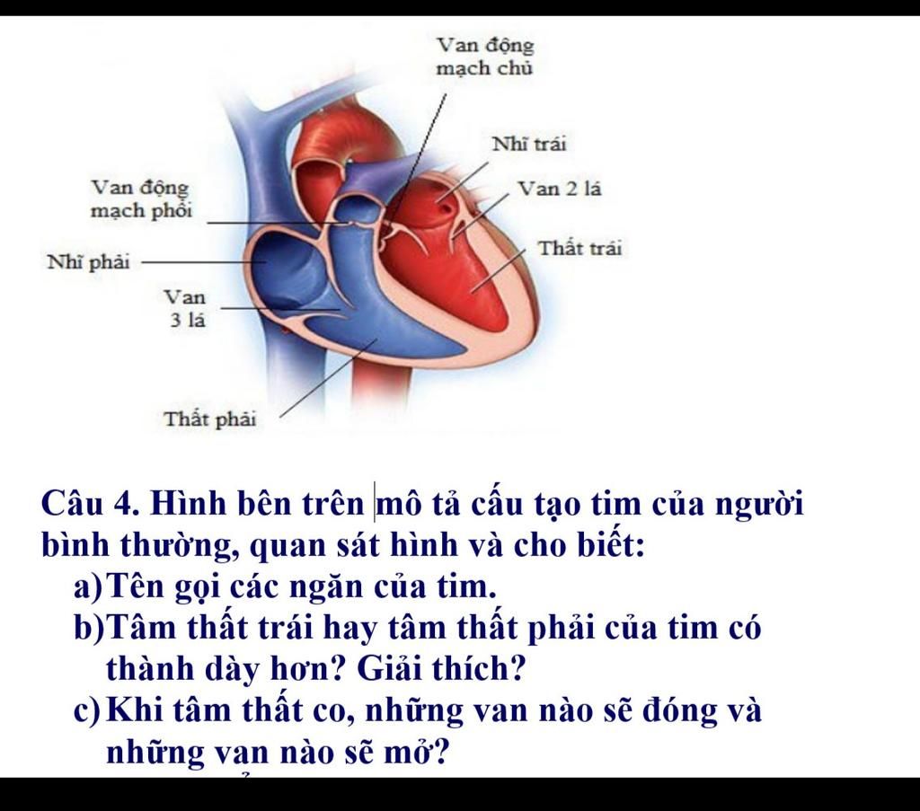 Cứu em đi mà em nhìn mà ko hiểu gì luôn nek HuhuhuhuhuhuhuhuhuhuhuVan ...
